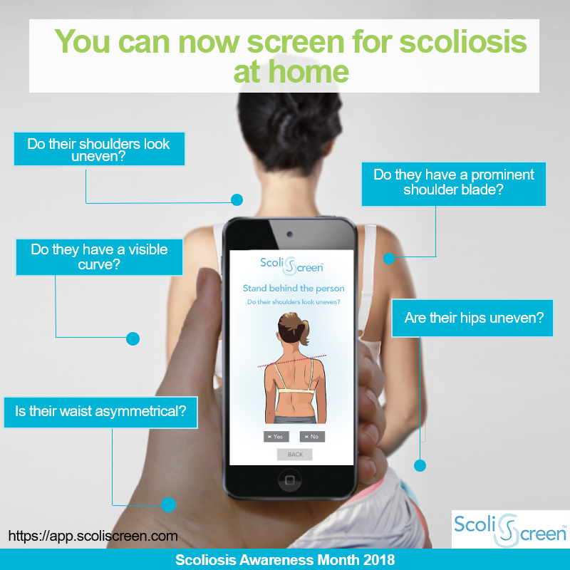 Adam's Test is a Basic Scoliosis Screening the Scoliometer is a More ...