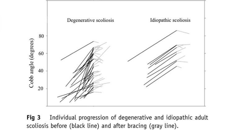 Scoliosis Degree of Curve Explanation Chart - Chiropractor in St. Augustine